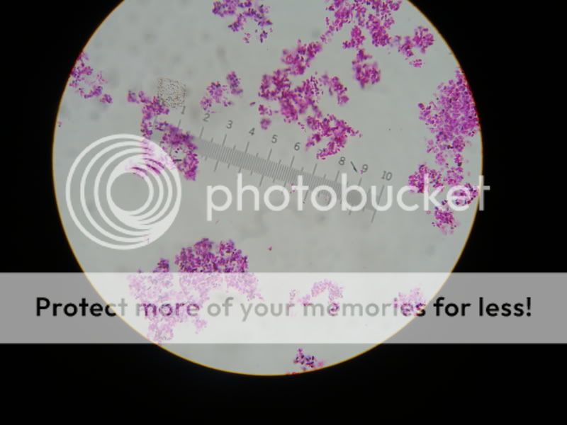 Saccharomyces Yeast 40x Photo by krystl_malit | Photobucket